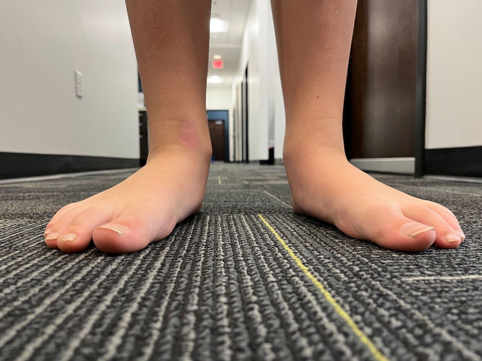 Barefoot Season: Is It Safe for Kids? | Pediatric Foot & Ankle