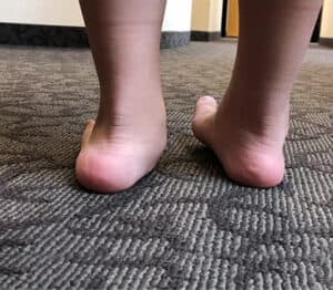 Hyprocure - Pediatric Foot & Ankle