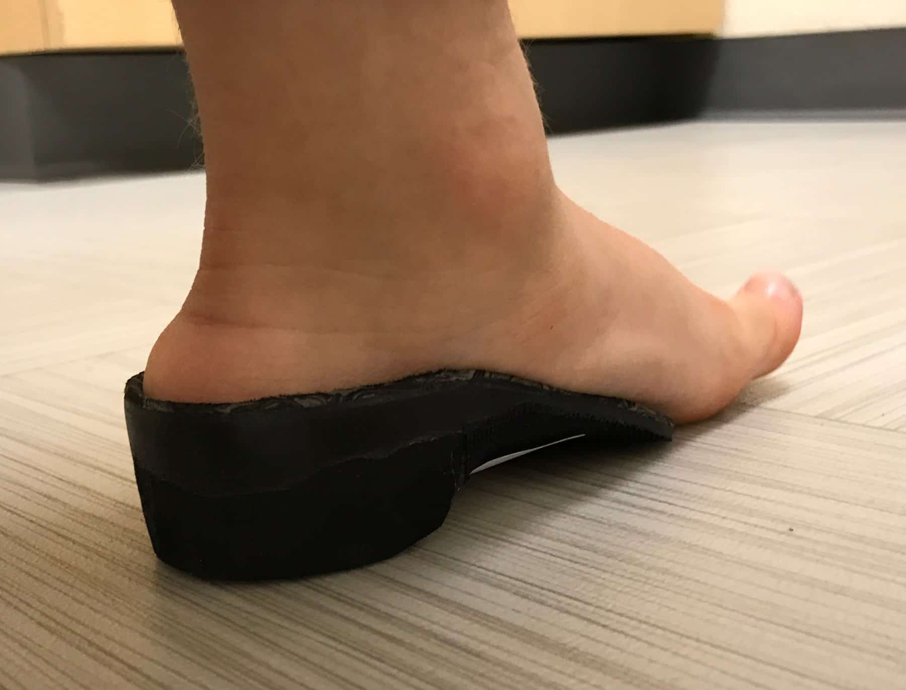 Does My Child Have Flat Feet? And What To Do About It - Pediatric Foot ...