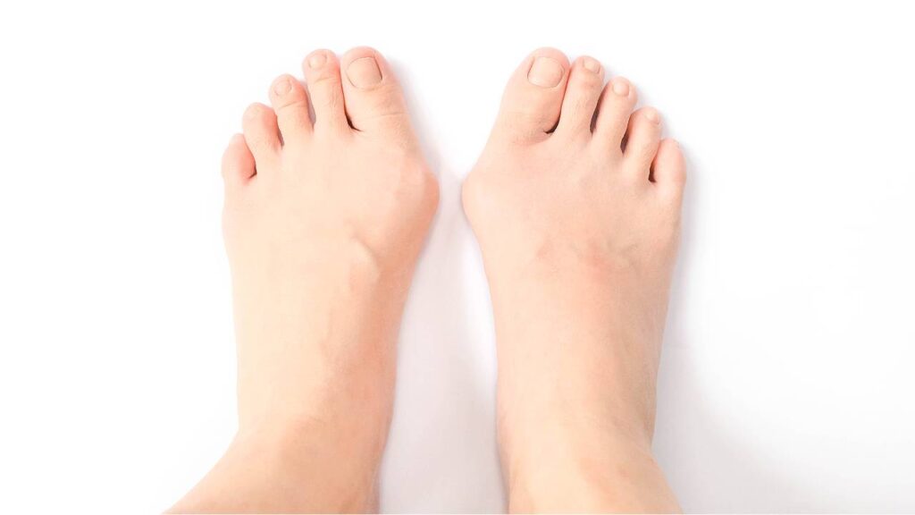 Pediatric Foot & Ankle, Children's Foot Doctor in Chandler AZ